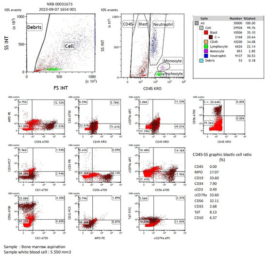 Comparison of Bone Marrow Biopsy and Flow Cytometry in Demonstrating ...