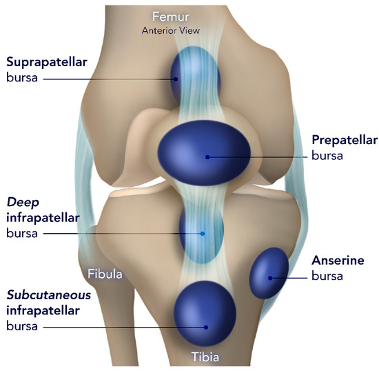 Patellar Non-Traumatic Pathologies: A Pictorial Review of Radiologic Findings