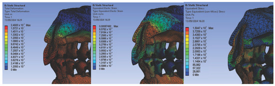 Simulation of an Orthodontic System Using the Lingual Technique Based on the Finite Element Method