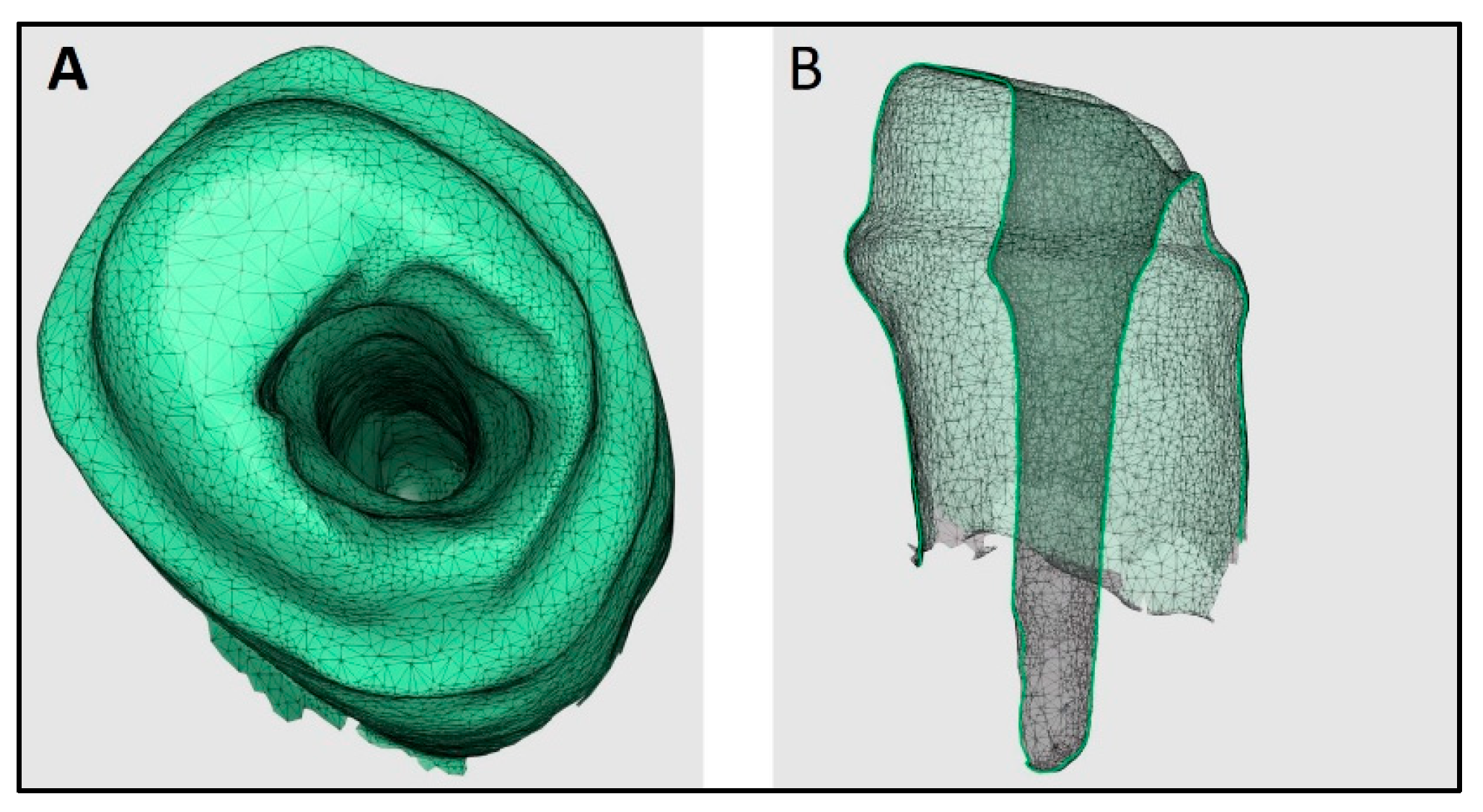 The Comparison of Accuracy of Post Space Digital Impressions Made by ...