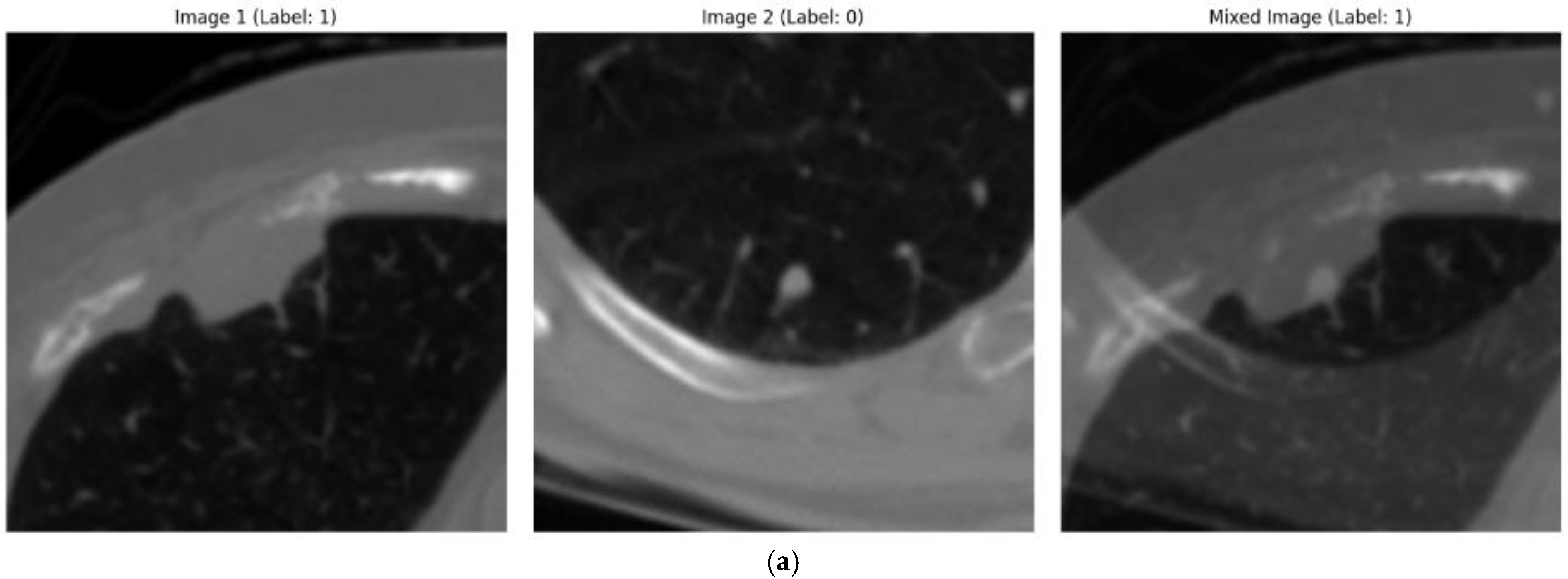 Toward Robust Lung Cancer Diagnosis: Integrating Multiple CT Datasets ...