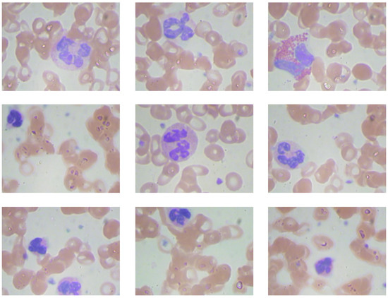 Automated Blood Cell Detection and Classification in Microscopic Images ...