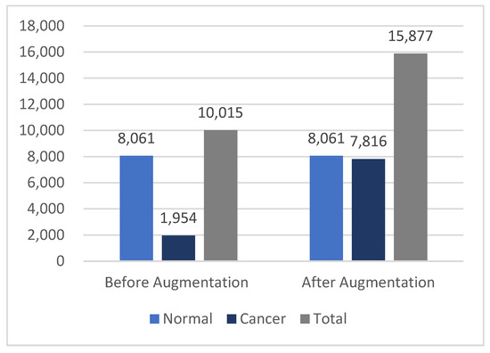 Skin Cancer Detection Using Transfer Learning and Deep Attention Mechanisms