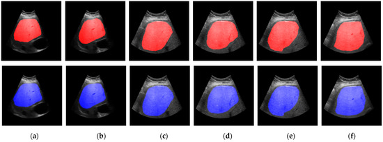 Adaptive Evolutionary Optimization of Deep Learning Architectures for ...