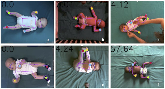 Marker-Less Video Analysis of Infant Movements for Early Identification ...