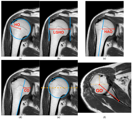 Shoulder Physiological Offset Parameters in Asian Populations—A ...