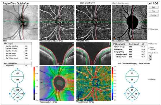 Quantitative Changes in Vascular and Neural Fibers Induced by ...