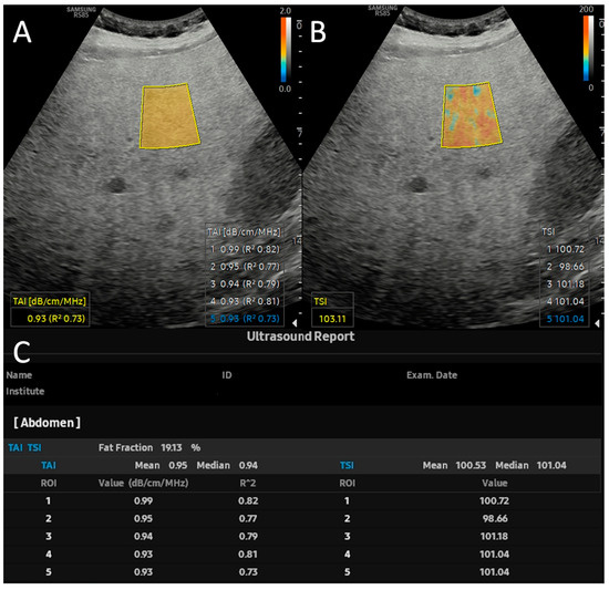 Construction of a Compound Model to Enhance the Accuracy of Hepatic Fat Fraction Estimation with ...