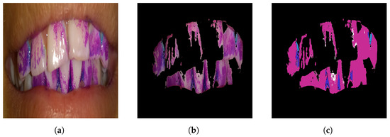 Deep Learning in Oral Hygiene: Automated Dental Plaque Detection via ...