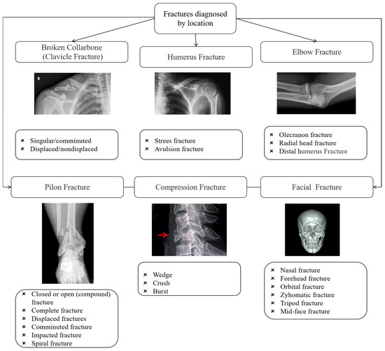 Lightweight Deep Learning Framework for Accurate Detection of Sports ...
