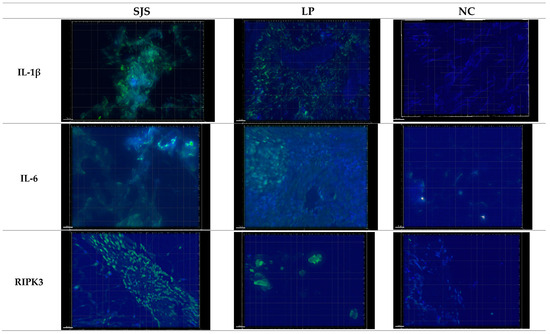 The Potential Roles of IL-1β, IL-6, and RIPK3 in the Pathogenesis of ...