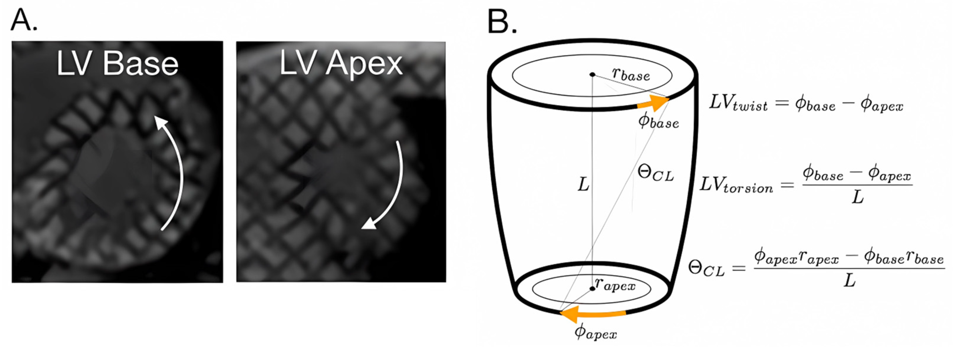 Left Ventricular Twist and Circumferential Strain from MRI Tagging ...