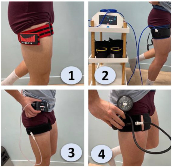 Can Blood Flow Restriction Be the Key to Reducing Quadriceps Weakness ...