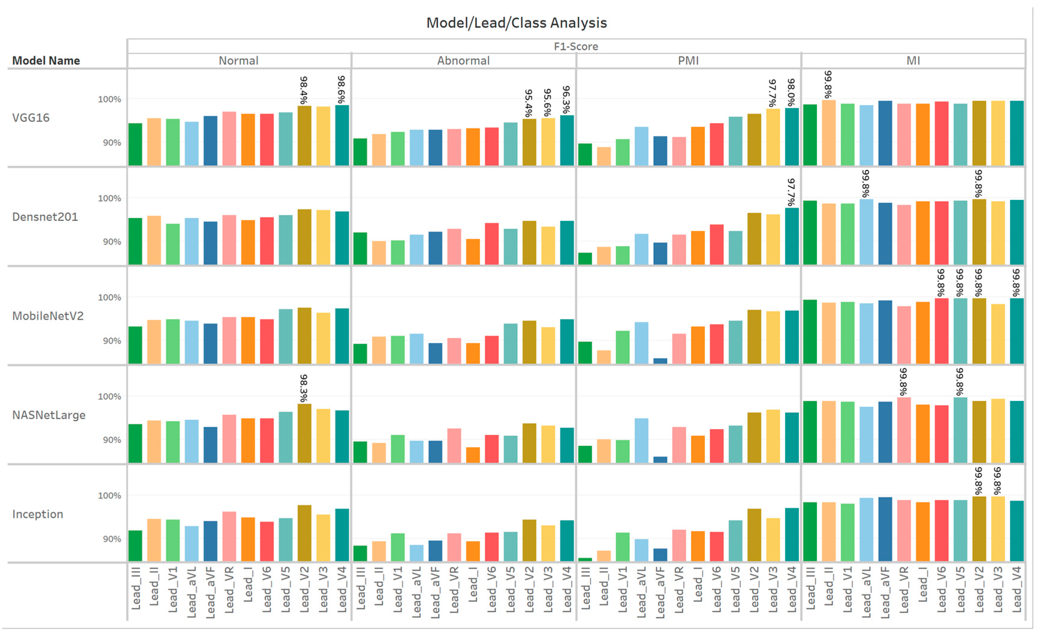 Deep Learning-Driven Single-Lead ECG Classification: A Rapid Approach ...