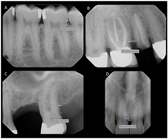 An Assessment of Deep Learning’s Impact on General Dentists’ Ability to ...