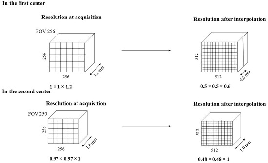 Addressing Multi-Center Variability in Radiomic Analysis: A Comparative ...
