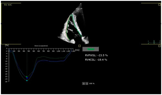 A Comparison of Long-Term Right Ventricular Functions in Children with ...