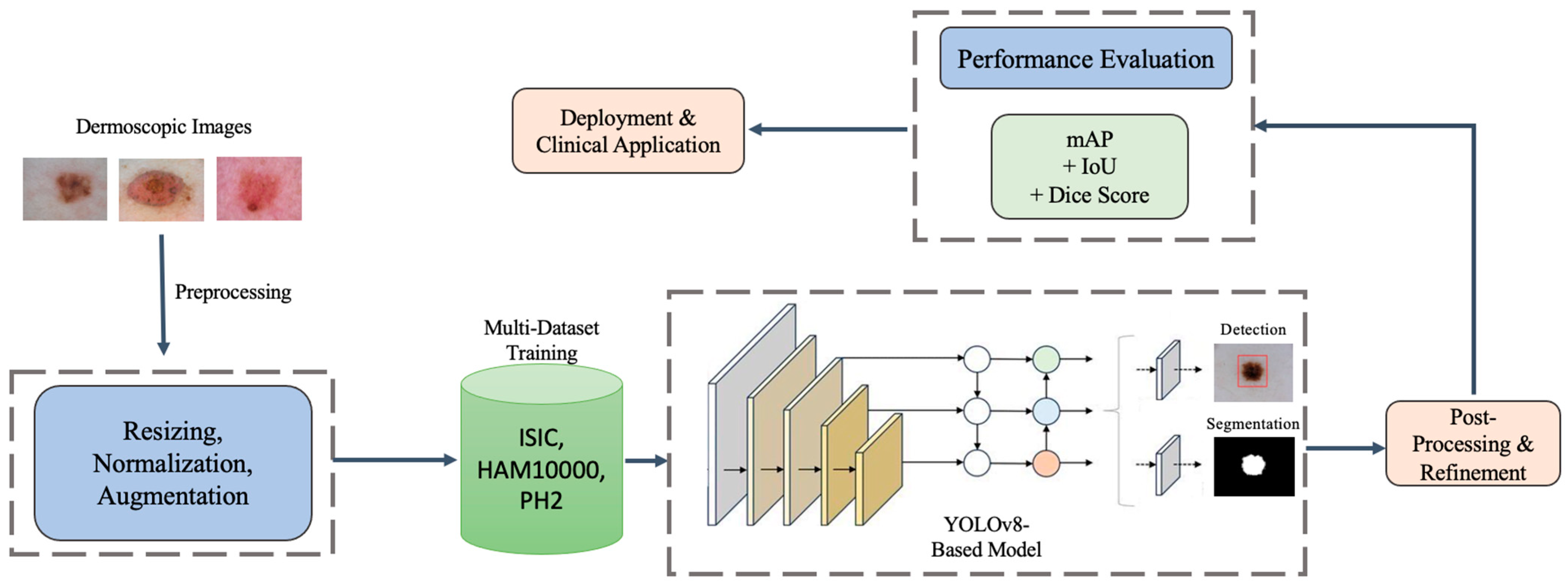 A Robust YOLOv8-Based Framework for Real-Time Melanoma Detection and Segmentation with Multi ...