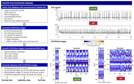 Detection of Atrial Fibrillation in Holter ECG Recordings by ECHOView Images: A Deep Transfer ...