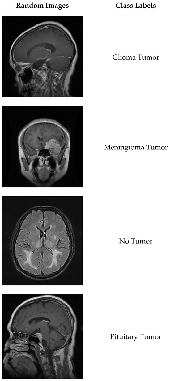 A Distillation Approach to Transformer-Based Medical Image ...