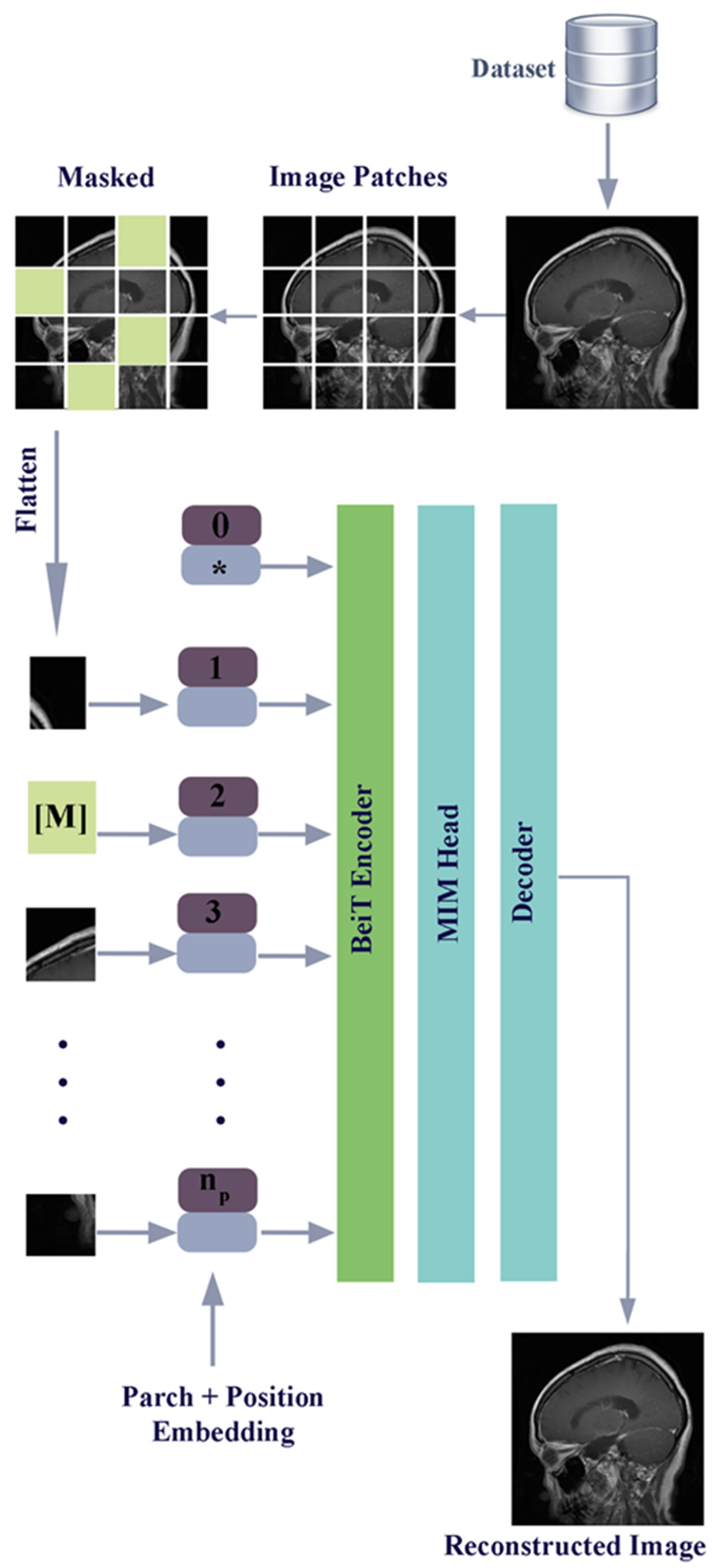 A Distillation Approach to Transformer-Based Medical Image Classification with Limited Data