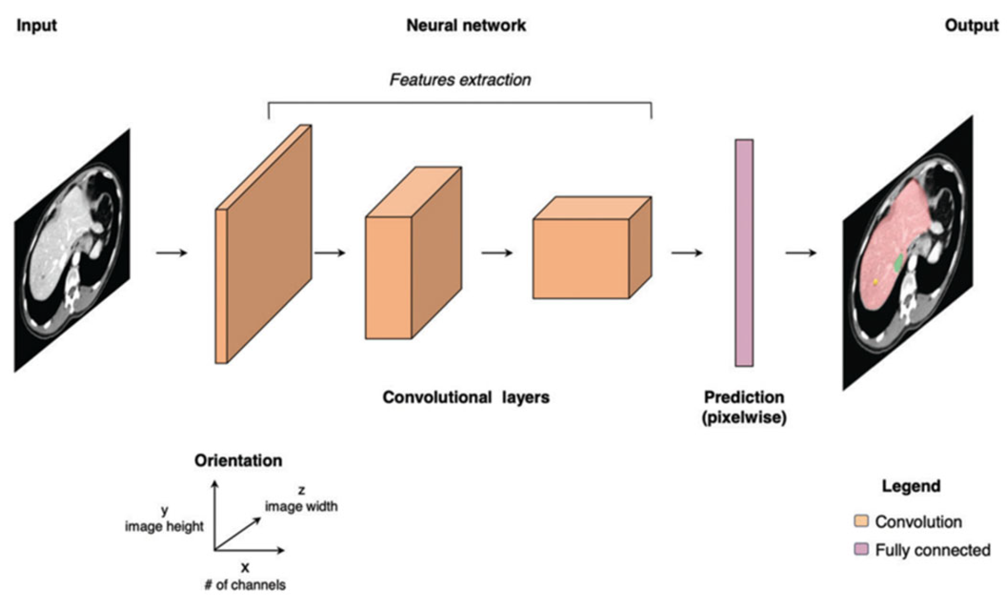 Computer-Aided Evaluation of Interstitial Lung Diseases