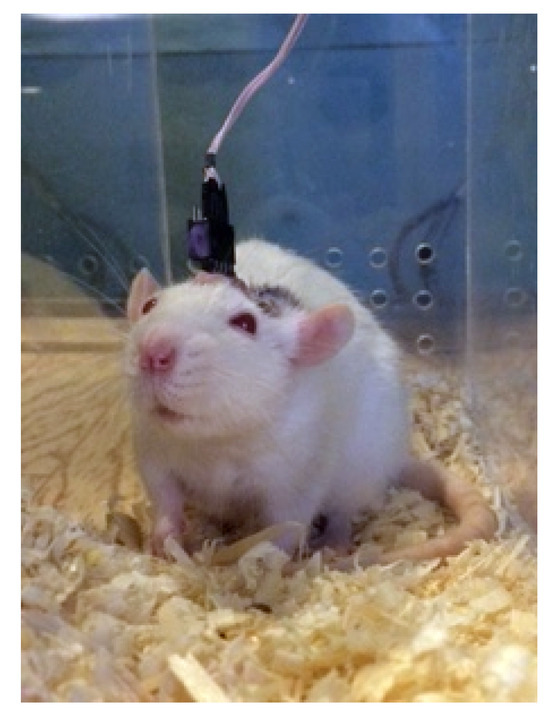 The Diagnostic Value of EEG Wave Trains for Distinguishing Immature ...