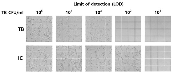 Development of the MTB/IC LAMP-MS Assay for Rapid Detection of ...