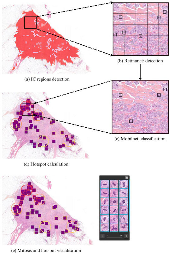Evaluating AI-Based Mitosis Detection for Breast Carcinoma in Digital Pathology: A Clinical ...