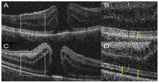 Expanding Application of Optical Coherence Tomography Beyond the Clinic ...