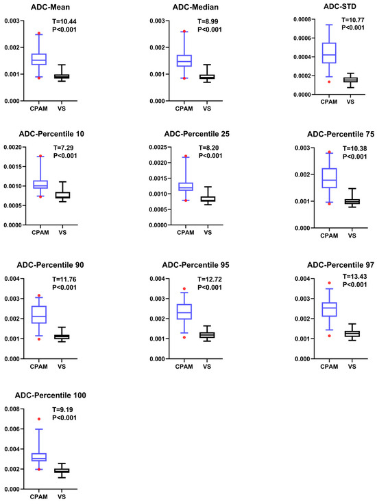 The Classification of Vestibular Schwannoma (VS) and Cerebellopontine ...