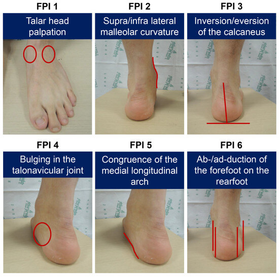 Reliability and Radiographic Correlation of the Foot Posture Index-6: A Multi-Rater Analysis in ...