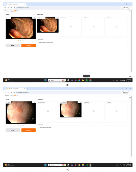 Multiclassification of Colorectal Polyps from Colonoscopy Images Using ...