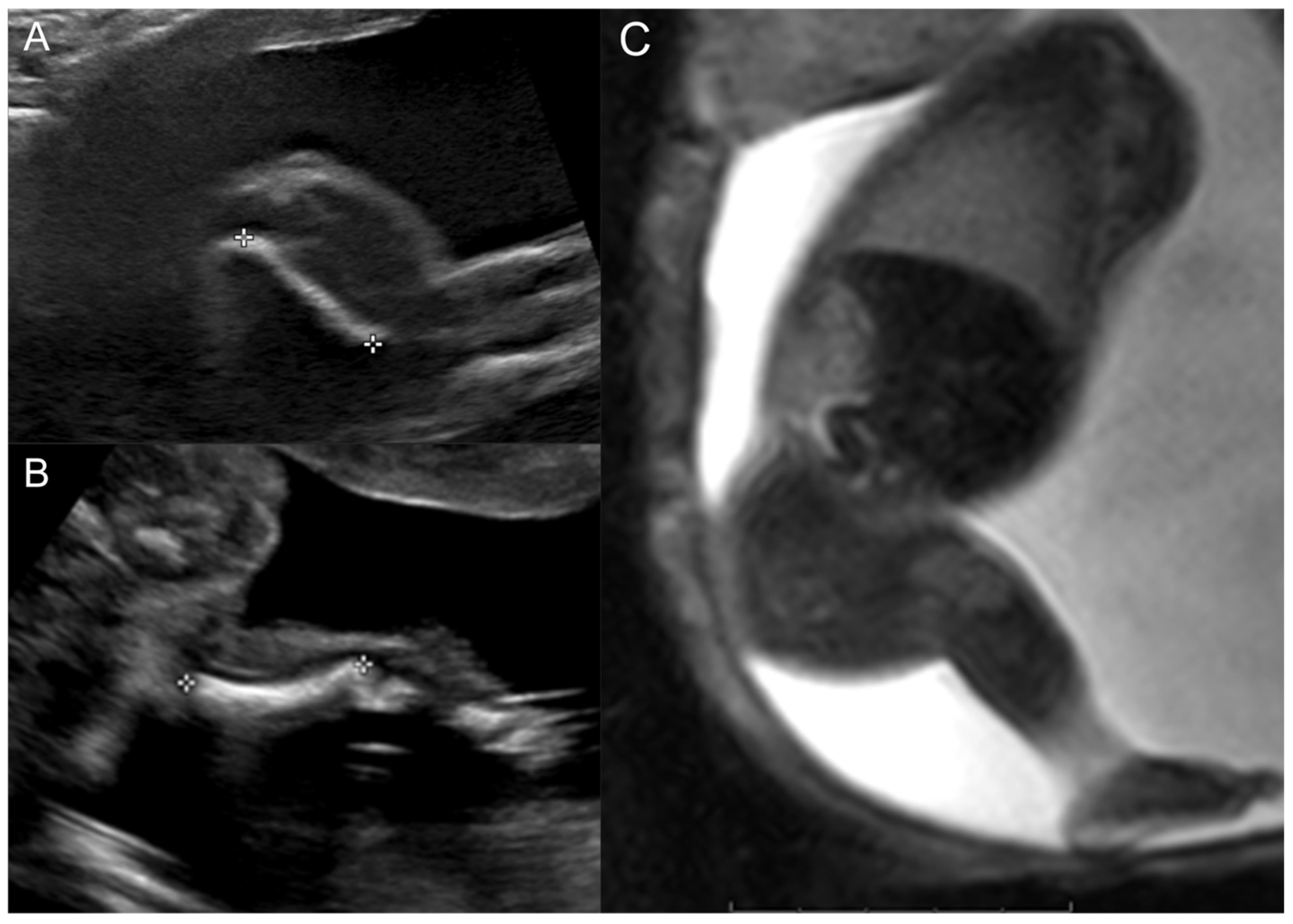 The Significance and Limitations of Pre- and Postnatal Imaging in the ...