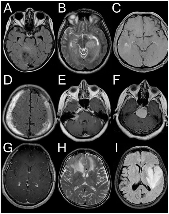 Do LLMs Have ‘the Eye’ for MRI? Evaluating GPT-4o, Grok, and Gemini on ...