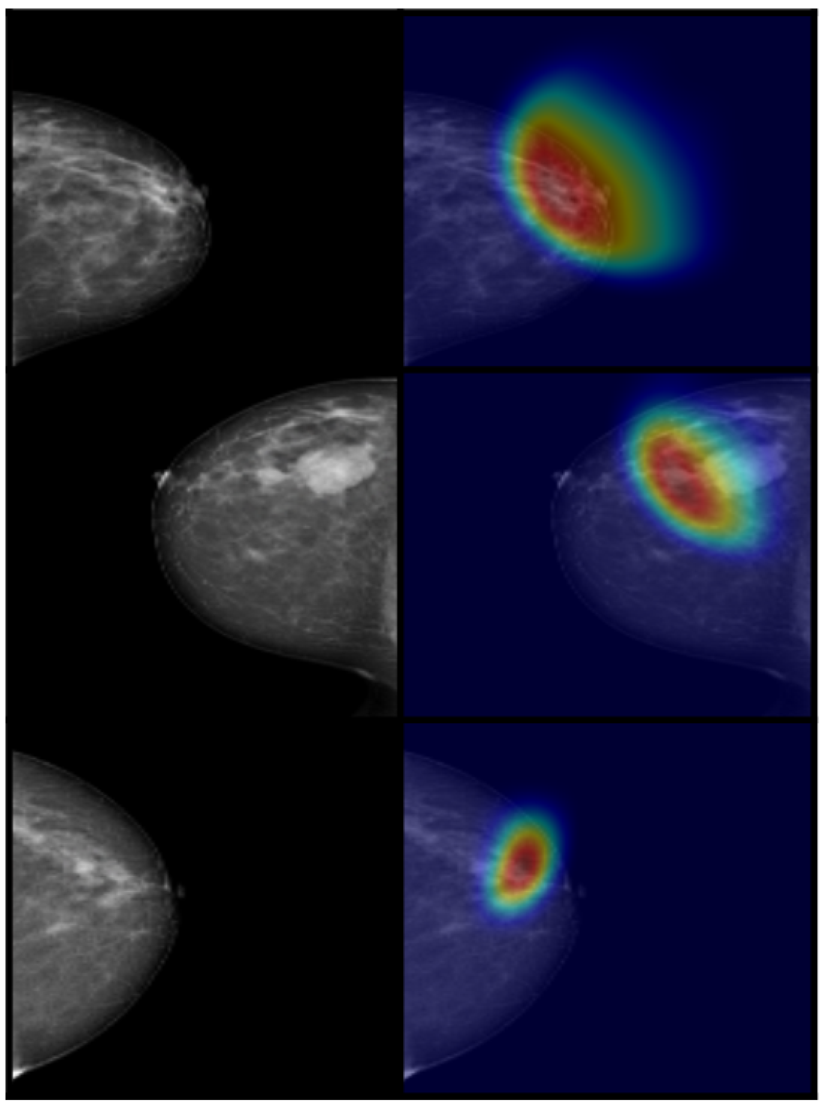 Multi-Scale Vision Transformer with Optimized Feature Fusion for ...