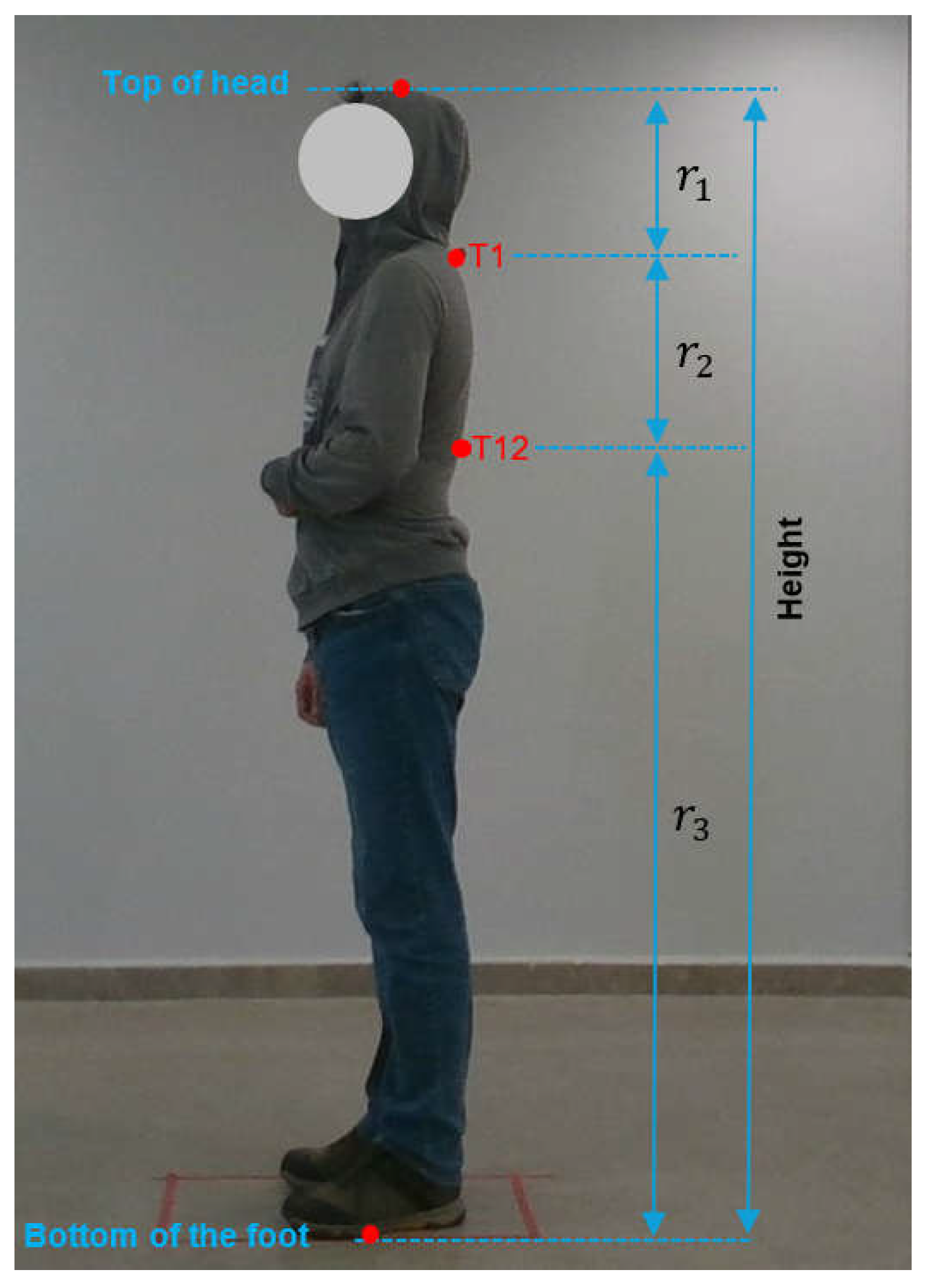 Automated Detection of the Kyphosis Angle Using a Deep Learning ...