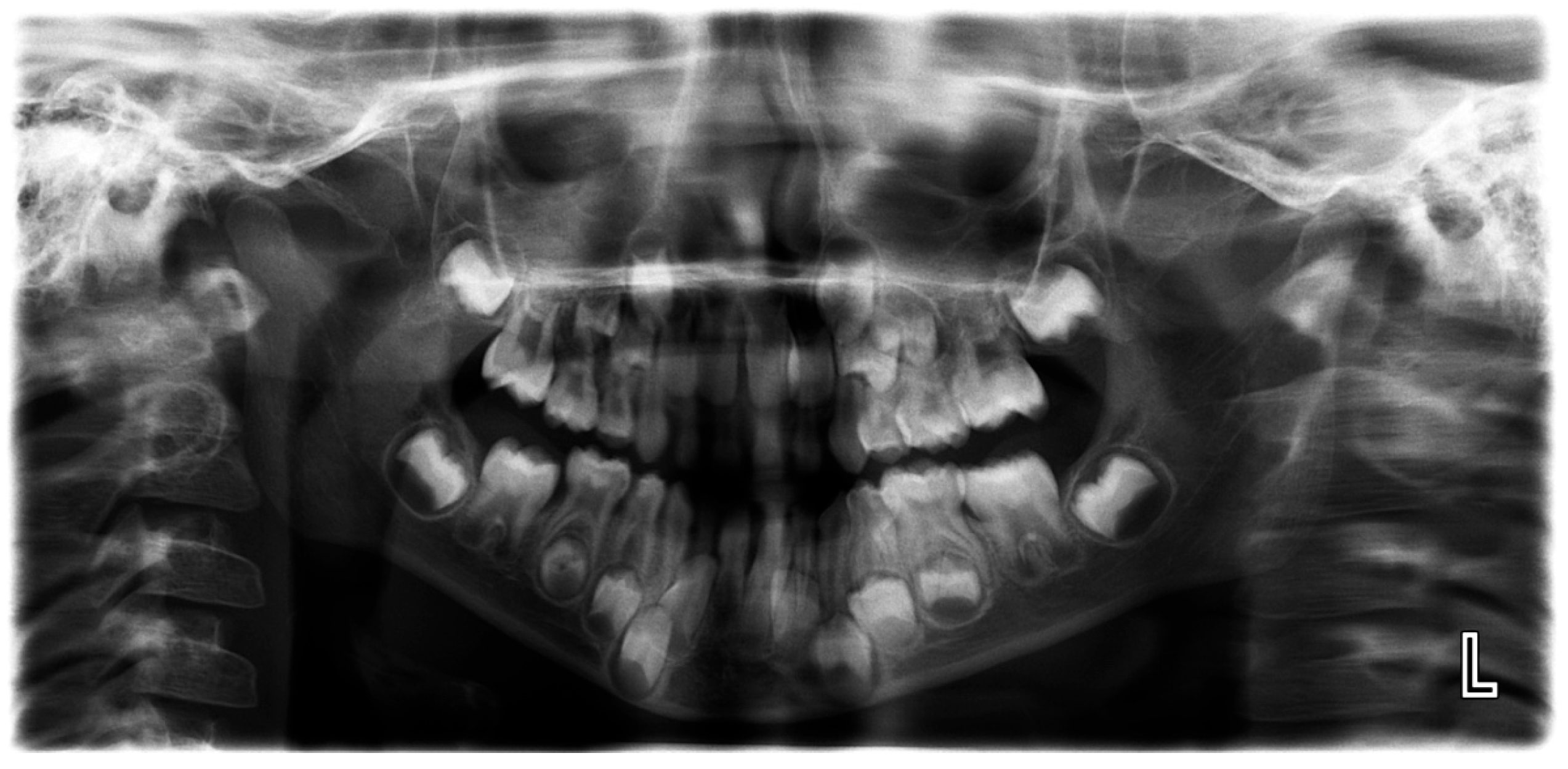 The Validation of an Artificial Intelligence-Based Software for the Detection and Numbering of ...