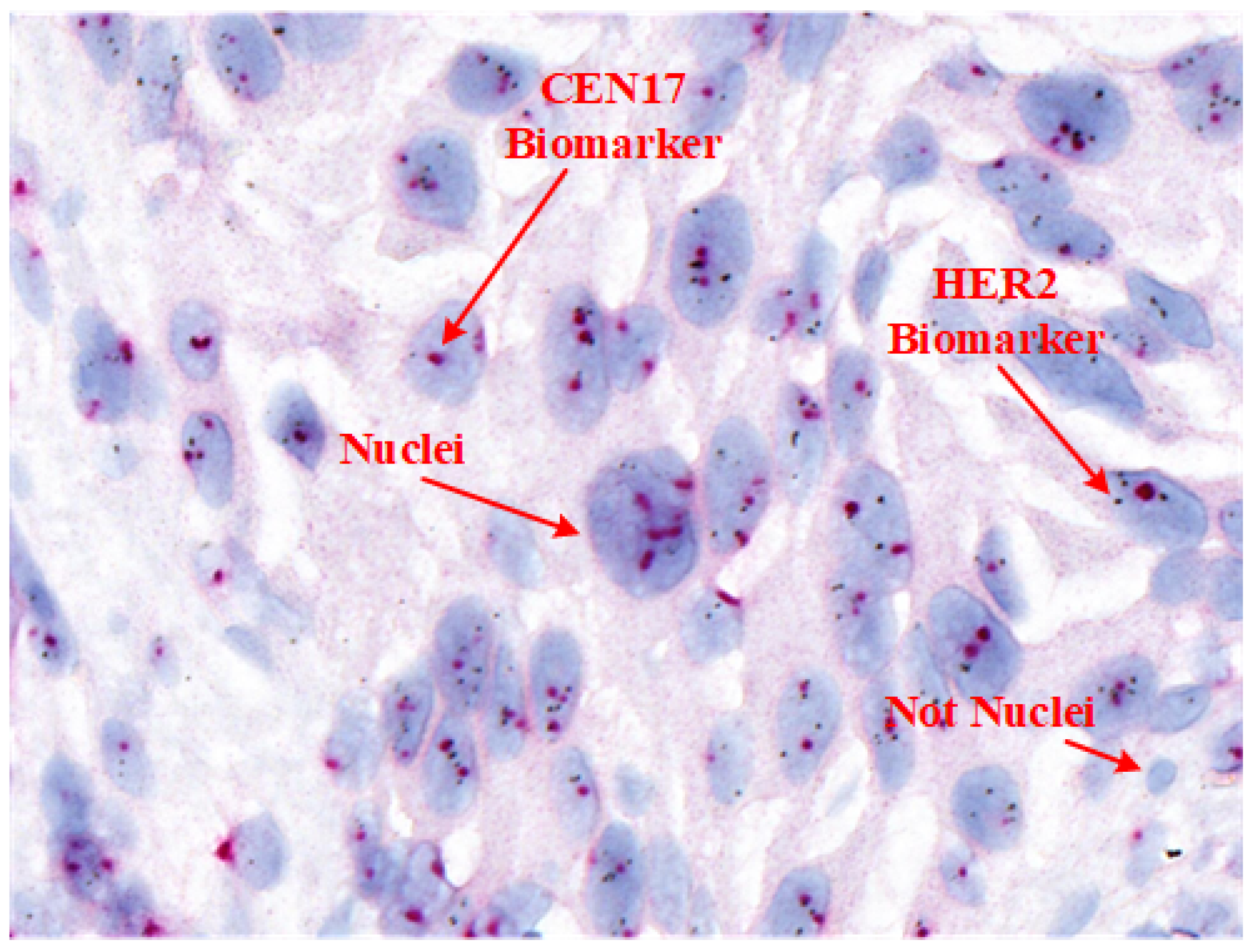Scalable Nuclei Detection in HER2-SISH Whole Slide Images via Fine-Tuned Stardist with Expert ...