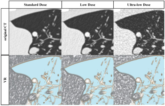 Performance Evaluation of Four Deep Learning-Based CAD Systems and ...