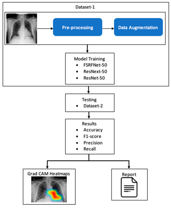 RADAI: A Deep Learning-Based Classification of Lung Abnormalities in Chest X-Rays