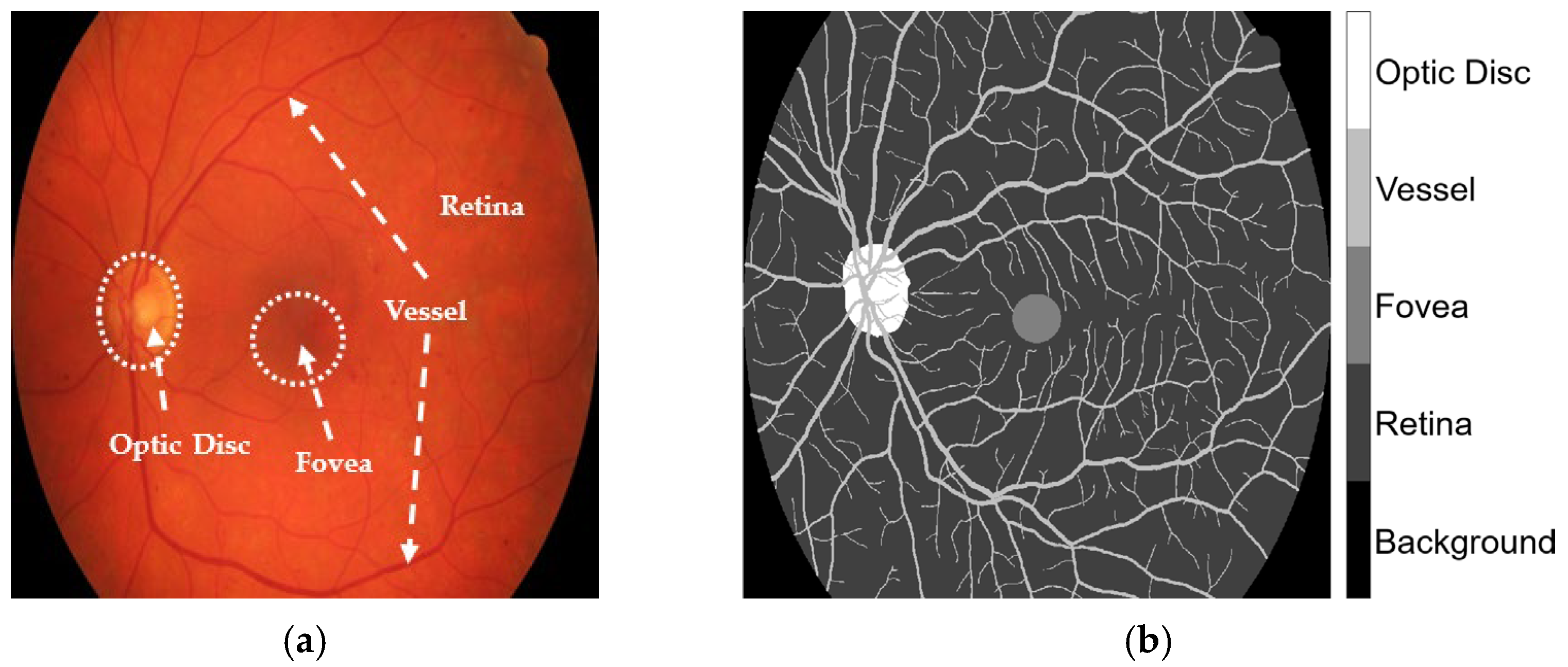 Confident Learning-Based Label Correction for Retinal Image Segmentation