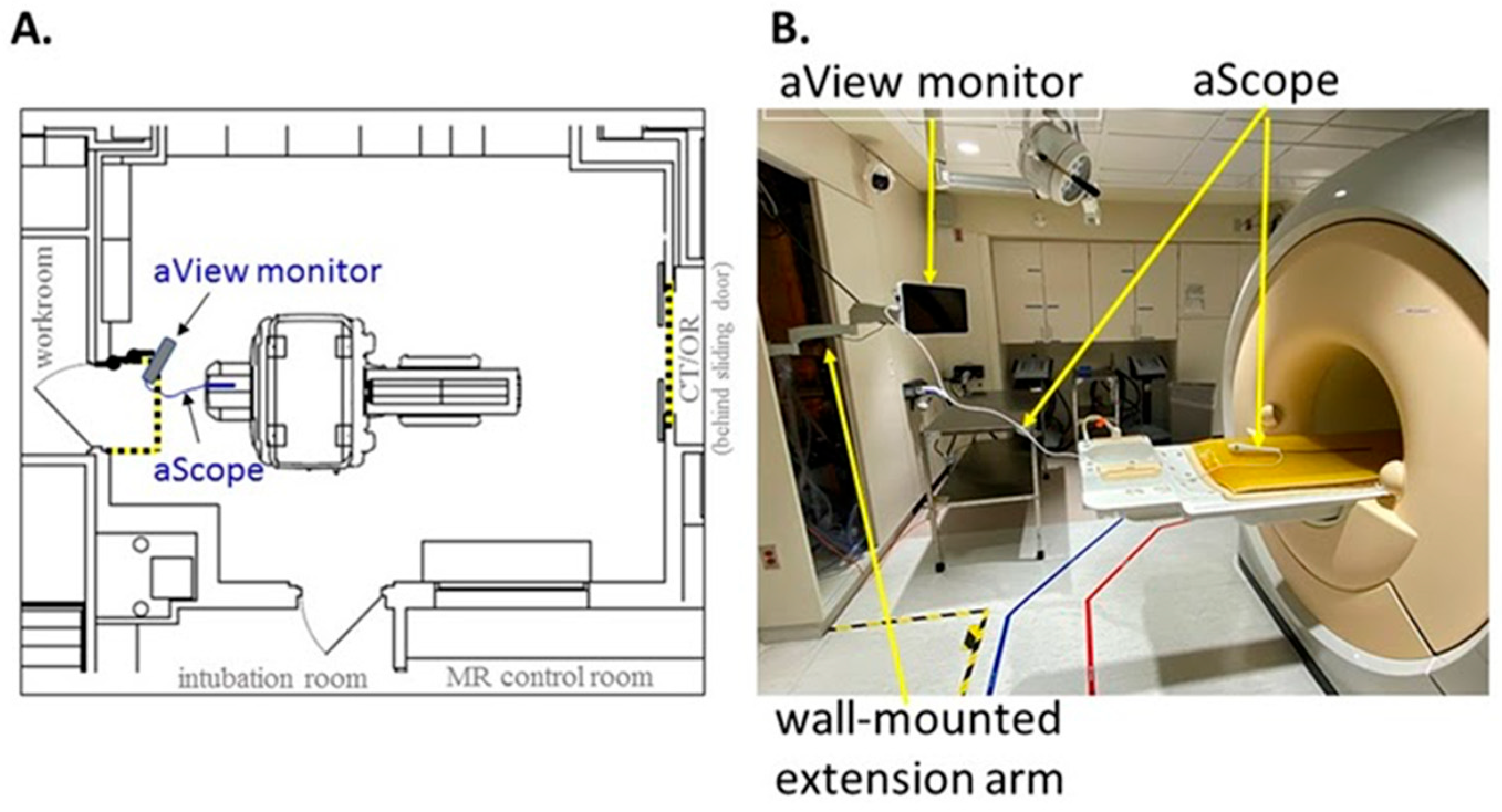 In-Bore MRI-Guided Ureteral Stent Placement During Prostate Cancer ...