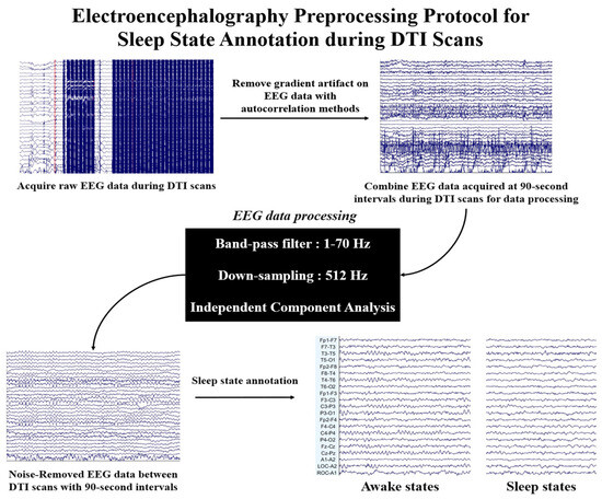 Feasibility of Observing Glymphatic System Activity During Sleep Using ...