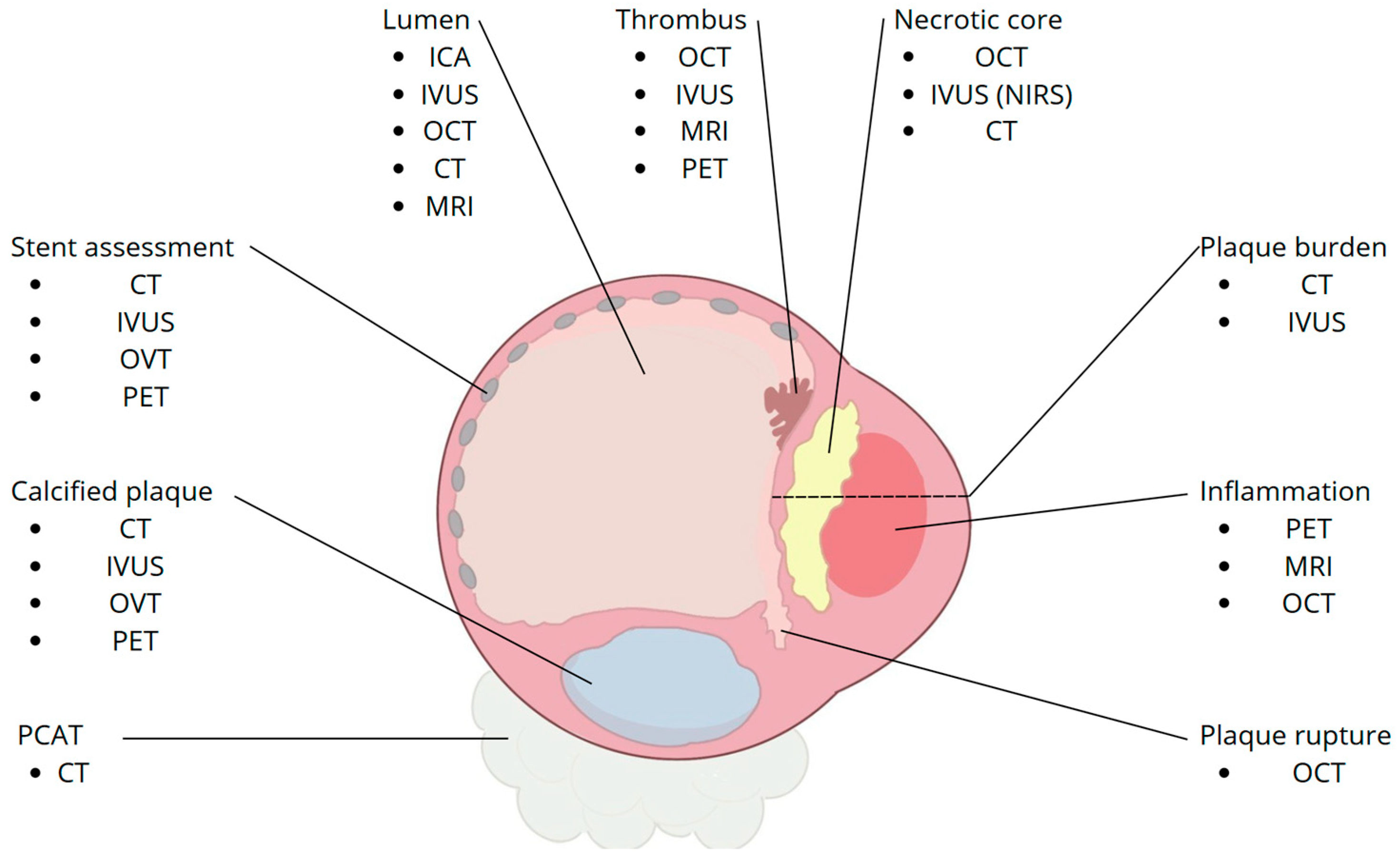 Machine Learning for Coronary Plaque Characterization: A Multimodal ...
