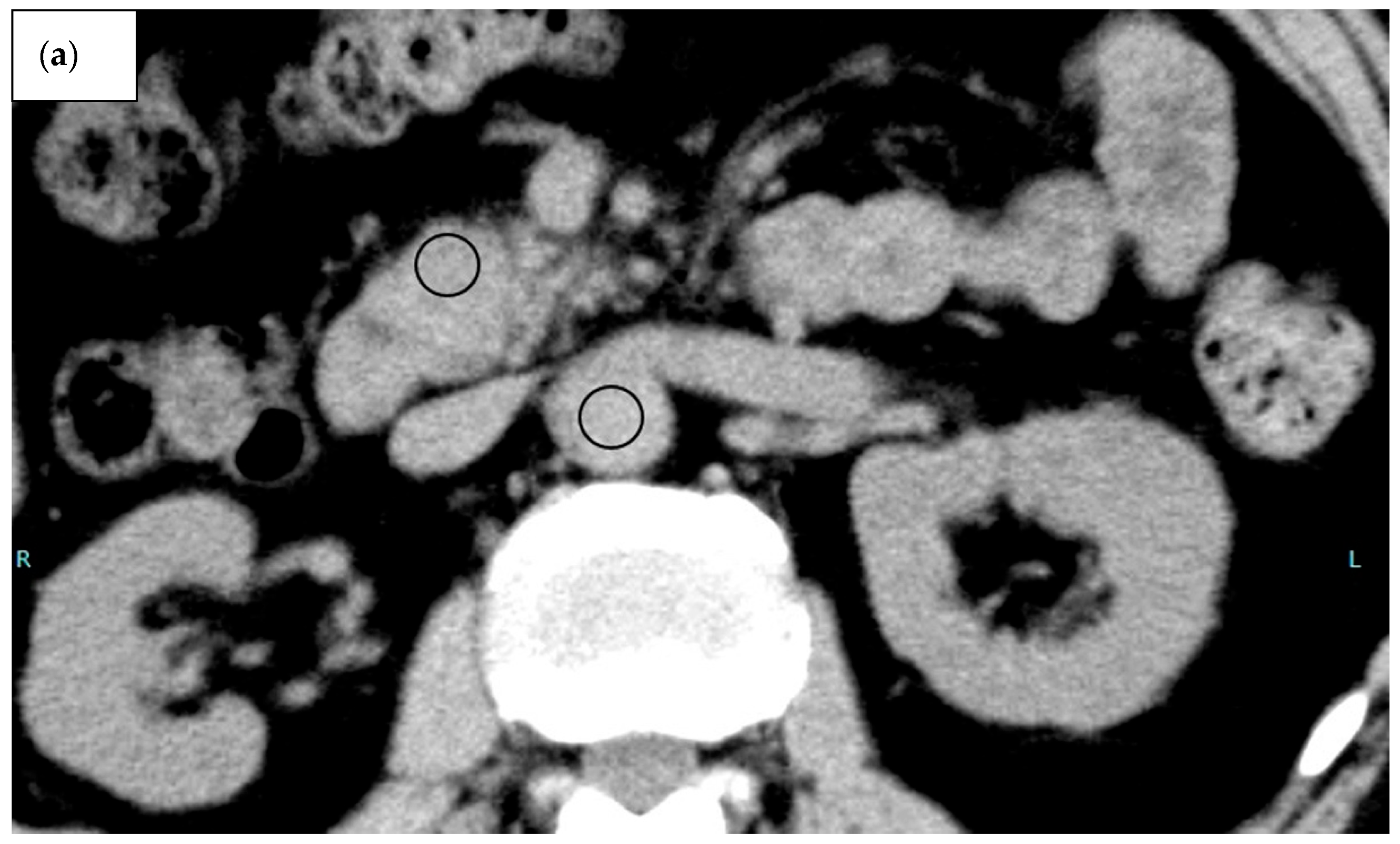 Effective Extracellular Volume Fraction Determined by Equilibrium ...