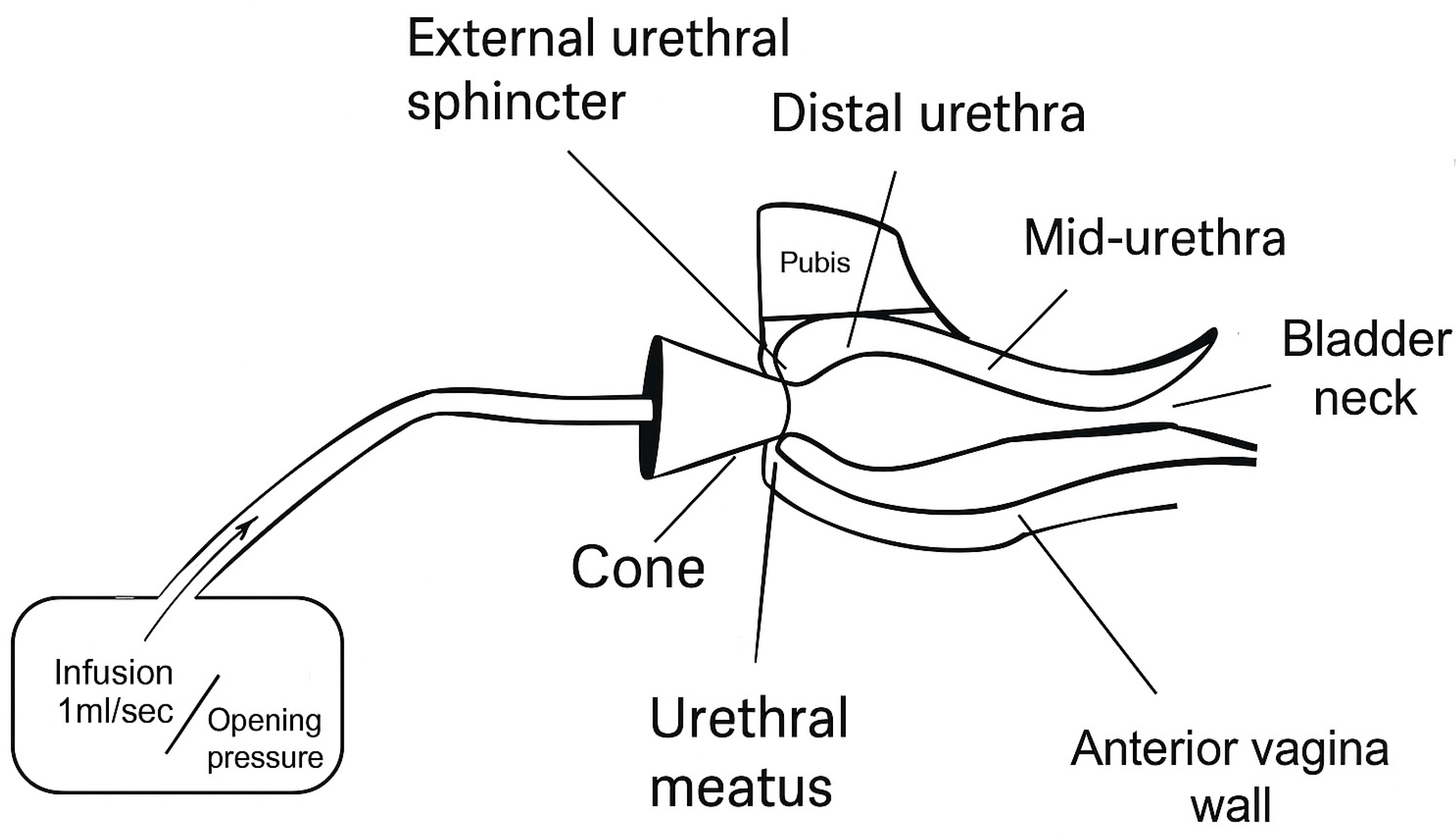 Dynamic URP: Revisiting Urethral Retro-Resistance Pressure for ...