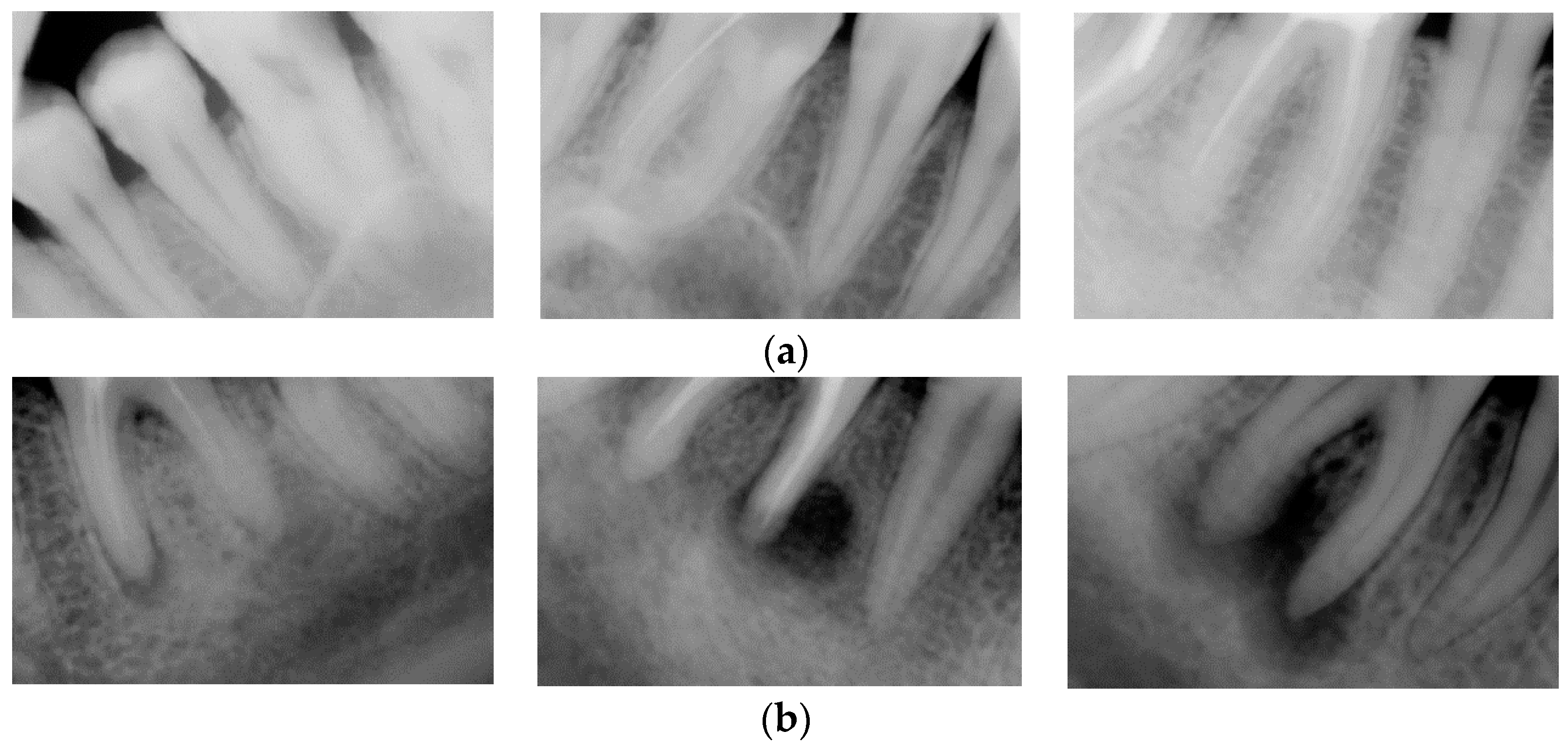 Explainable CNN–Radiomics Fusion and Ensemble Learning for Multimodal ...