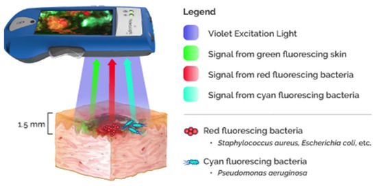 How Can Technology Improve Burn Wound Care: A Review of Wound Imaging ...