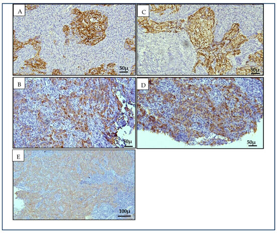 Evaluation of CK8/18 and CK19 Expression as Adjunct Immunohistochemical ...